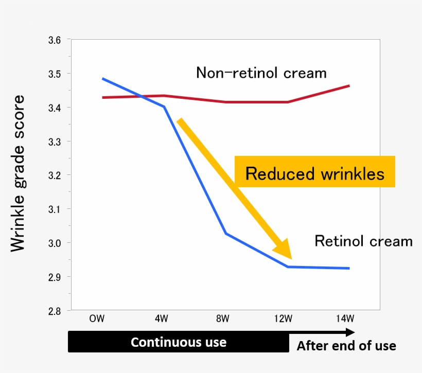 Download Image46 - 0kb - Diagram - Free Transparent PNG Download - PNGkey