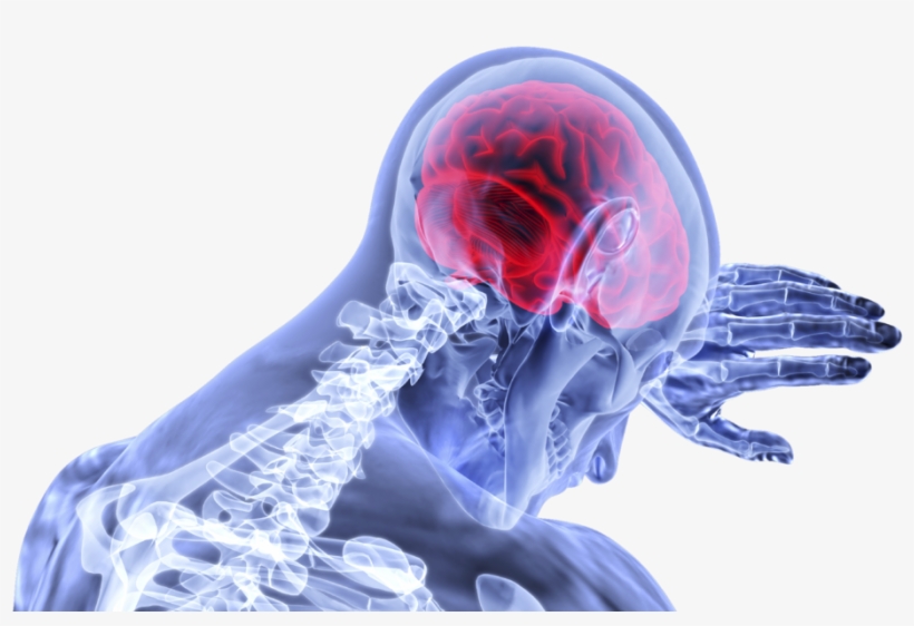 Brain, Inflammation, Stroke, Medical, Healthcare - Poškodbe Možganov ...