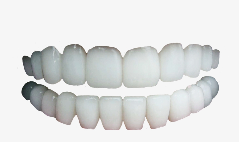 Human Teeth Png Svg Library Download - Human Tooth - Free Transparent ...