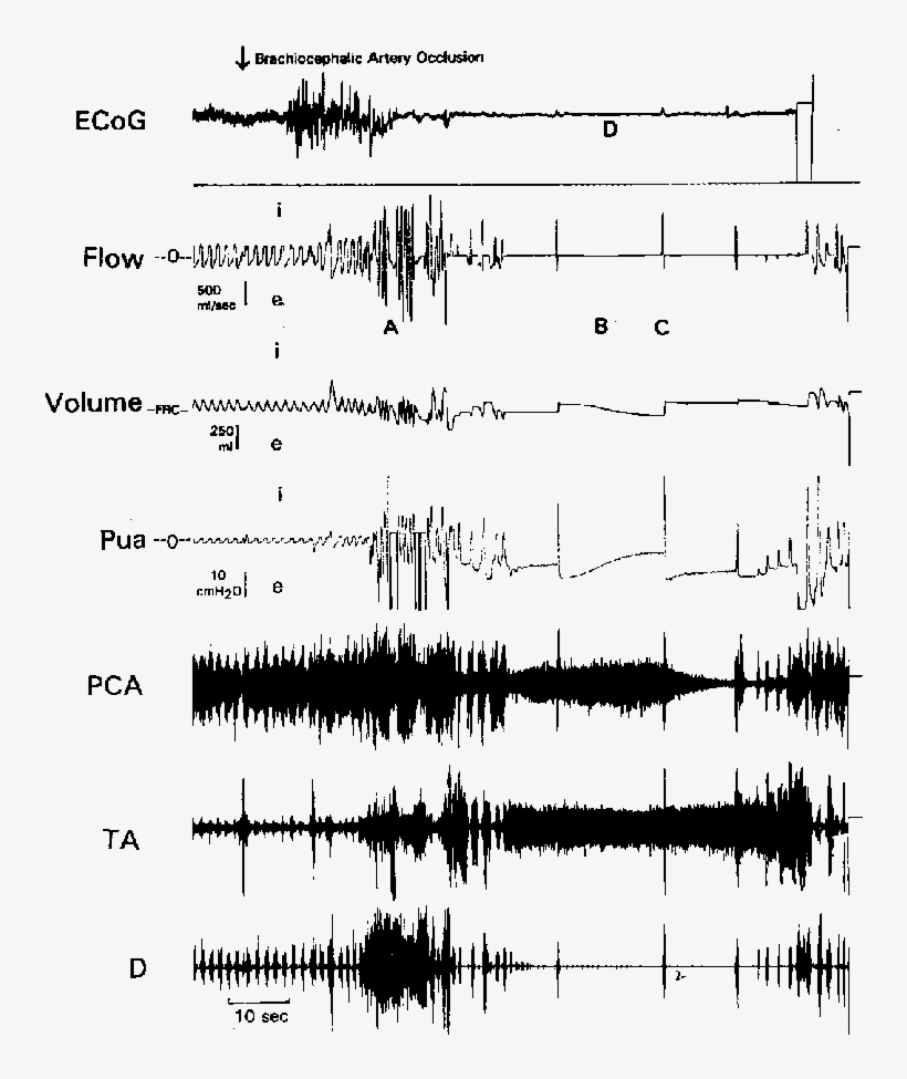 This Time Trace Of Ecog, Airflow, Volume, Pua, And - Sheet Music - Free ...