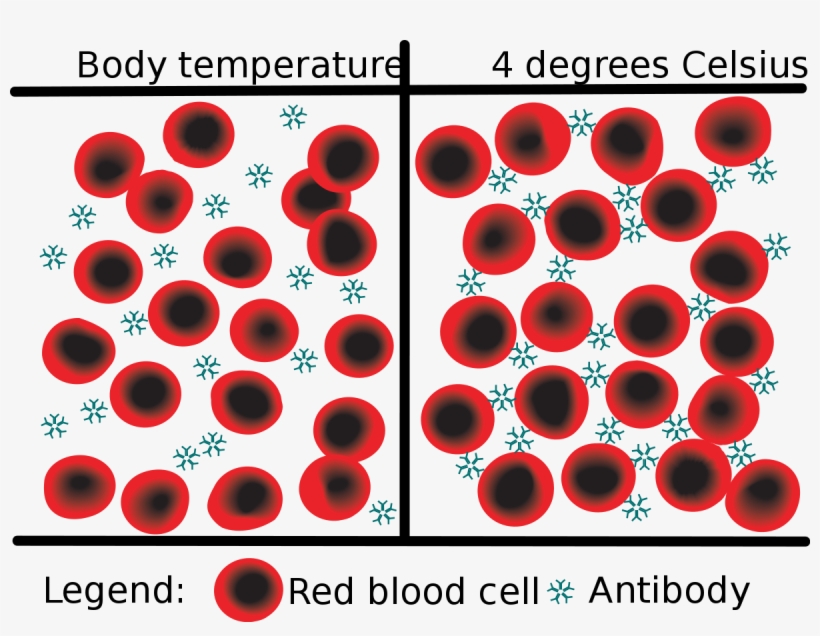 Heterophile Test - Free Transparent PNG Download - PNGkey