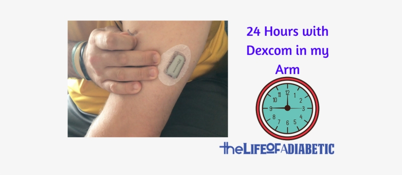 24 Hours With A Dexcom Arm Site - Dexcom G6 On Arm - Free Transparent ...