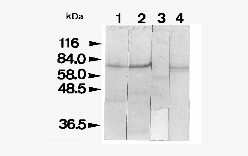 Western Blot Of Archaea - Paper - Free Transparent PNG Download - PNGkey
