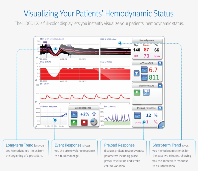 Hemodynamics - Free Transparent PNG Download - PNGkey