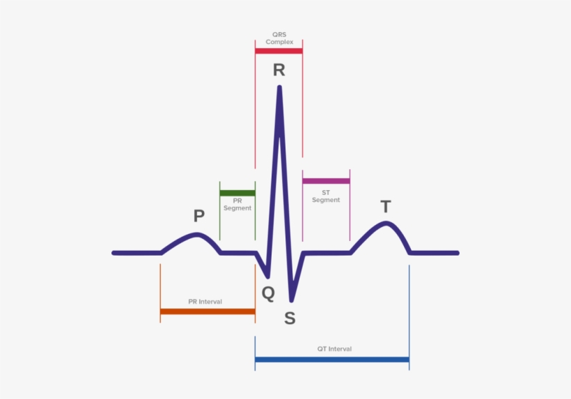 Equipment For Measuring Ecg - Normal Sinus Rhythm - Free Transparent ...