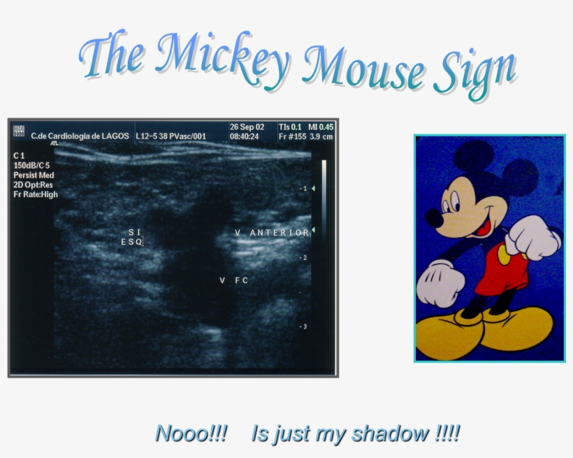 Mickey Mouse Sign - Mickey Mouse - Free Transparent PNG Download - PNGkey