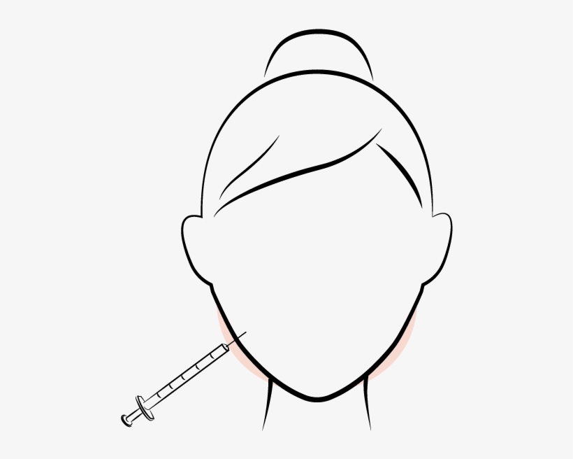 What Is Botulinum Toxin Type A (botox) - Line Art - Free Transparent ...