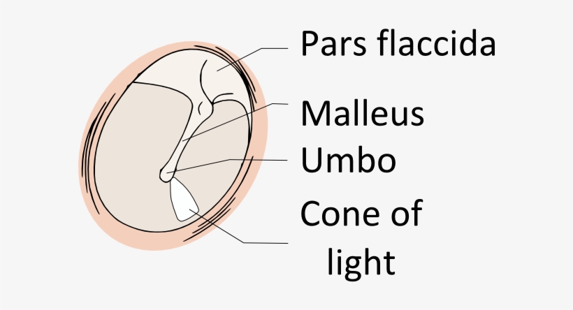 Tympanic Membrane Pars Flaccida - Free Transparent PNG Download - PNGkey