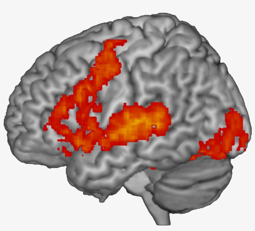 Your Brain On Words - Functional Magnetic Resonance Imaging - Free ...