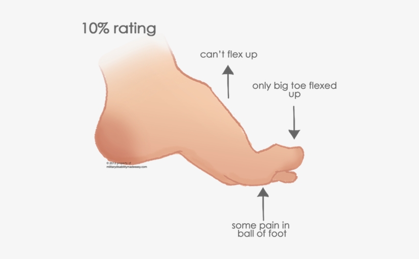 The Foot 6 - Toe Flex - Free Transparent PNG Download - PNGkey