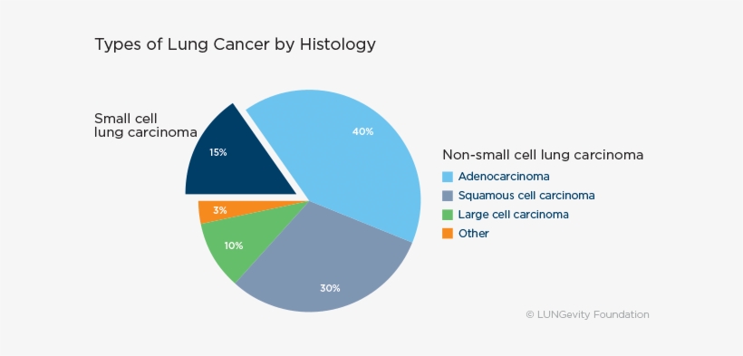 Types Of Lung Cancer - Common Is Lung Cancer - Free Transparent PNG ...