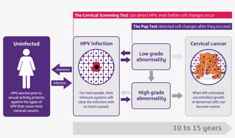 Progression Of Hpv To Cervical Cancer - Cosco Ada Restroom Signs, Men ...