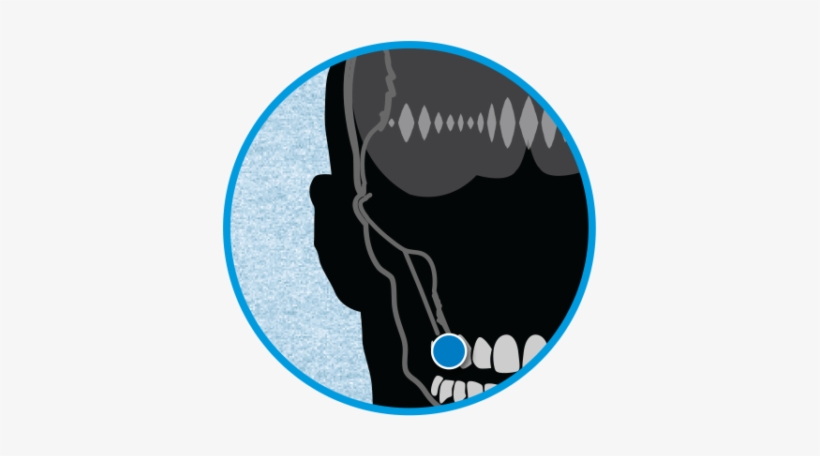 Molar Mic - Free Transparent PNG Download - PNGkey