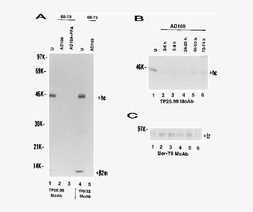 Expression Of Mhc Class I Heavy Chains In Hcmv Wild - Strain - Free ...