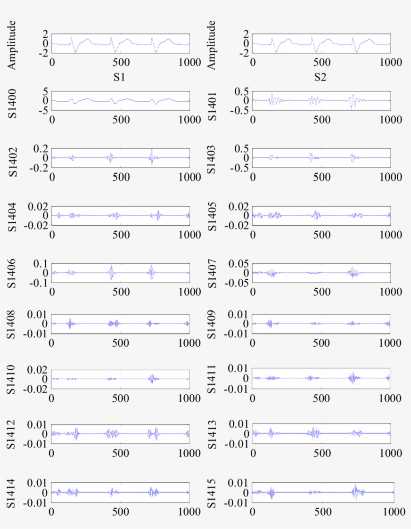 Results Of Ecg Signal Decomposition Using Wpd - Electric Blue - Free ...