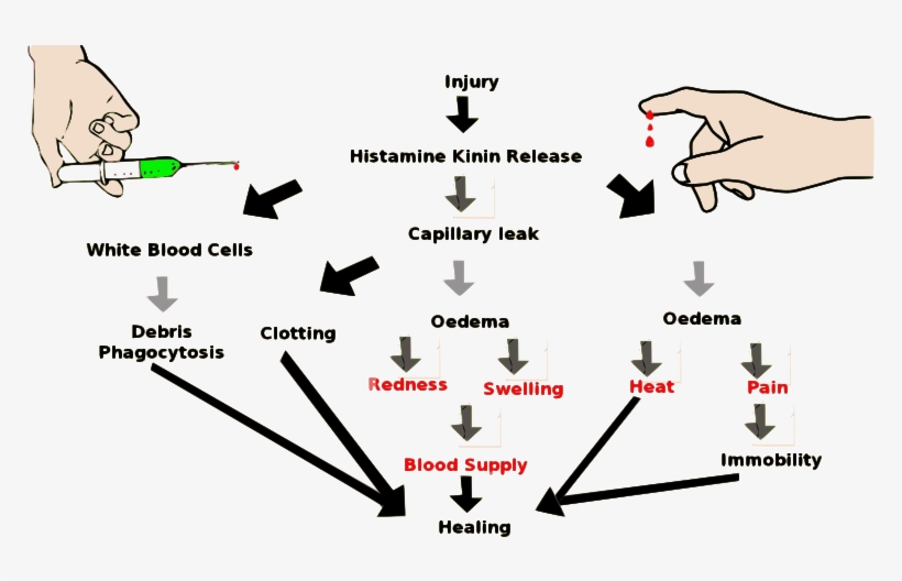 Inflammation Clipart Icon Png - Inflammation - Free Transparent PNG ...