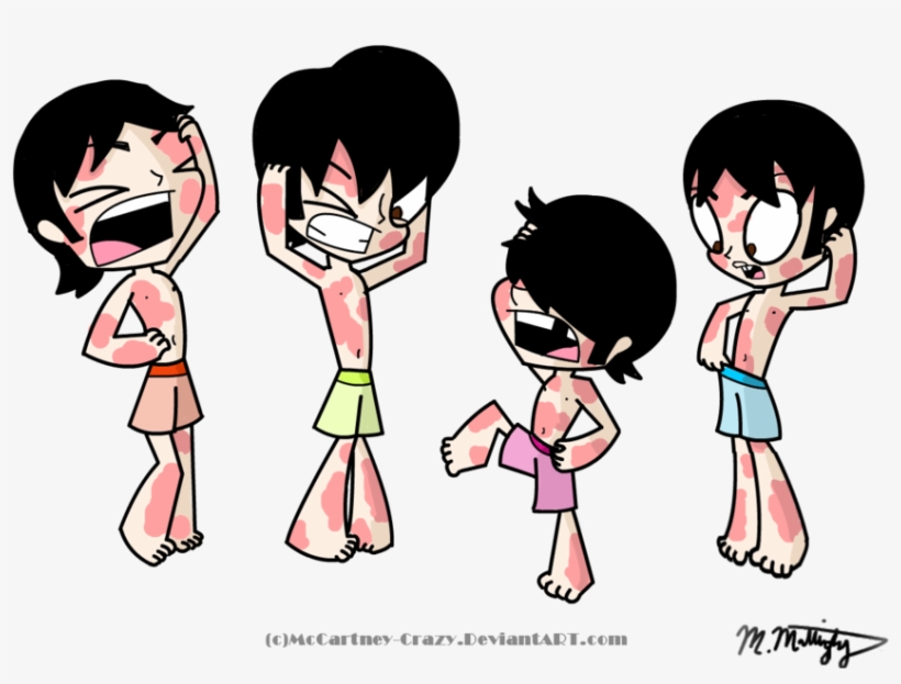 Itchy Rash Clipart - Rash Cartoon Png - Free Transparent PNG Download ...