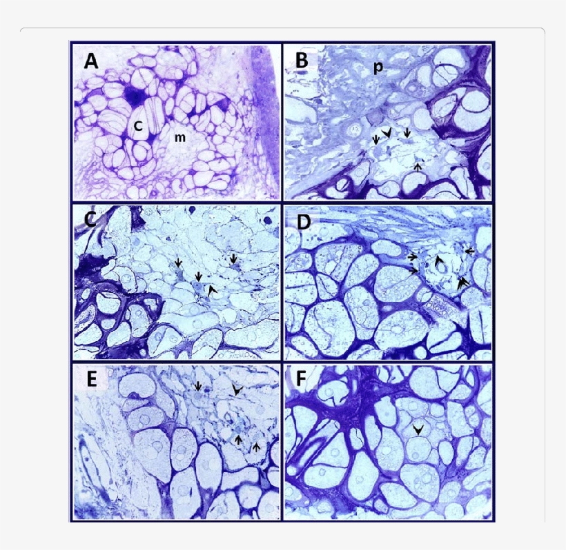 Semi-thin Sections Stained With Toluidine Blue - Free Transparent PNG ...