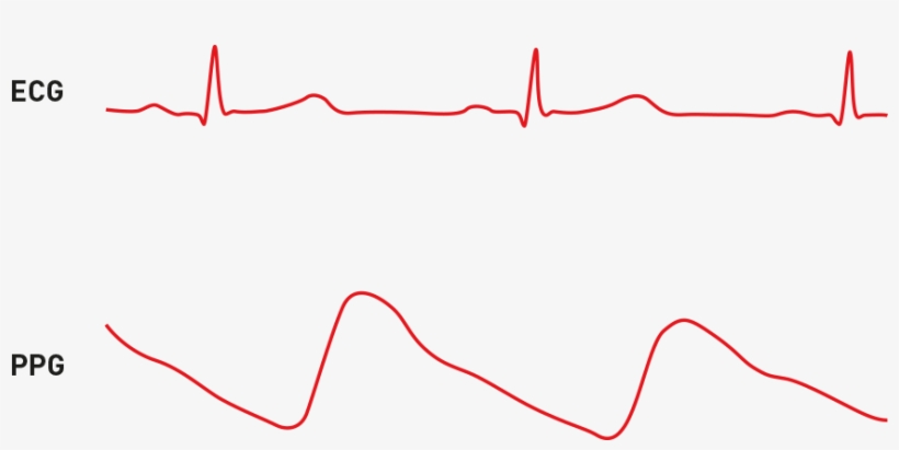 The Two Signals - Ecg Ppg - Free Transparent PNG Download - PNGkey
