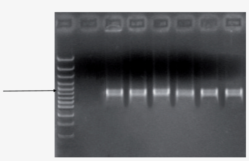 Detection Of X - Free Transparent PNG Download - PNGkey