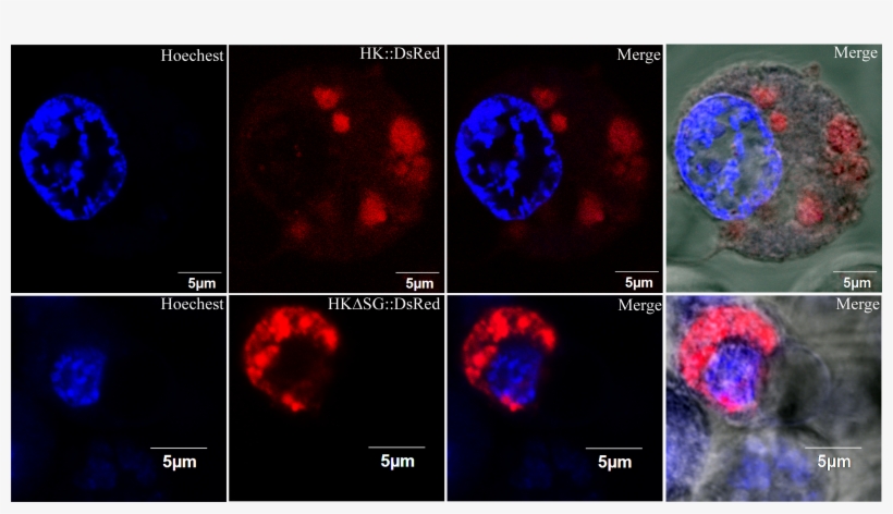 Subcellular Localization Of Hk - Free Transparent PNG Download - PNGkey