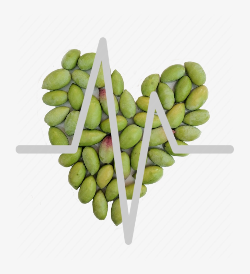 Cardiovascular Diseases Are The Most Common Causes - Free Transparent ...