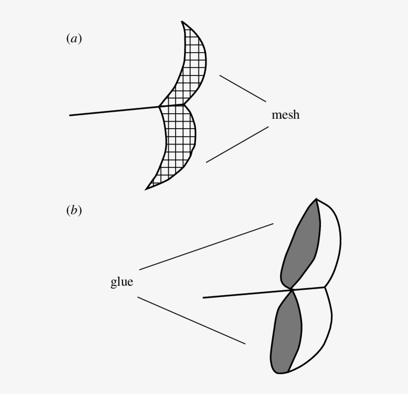 Closure By Application Of A Light Mesh Glued To The - Diagram - Free ...