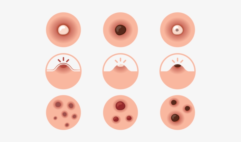 Pimple Png - Icon Anti Pimple - Free Transparent PNG Download - PNGkey