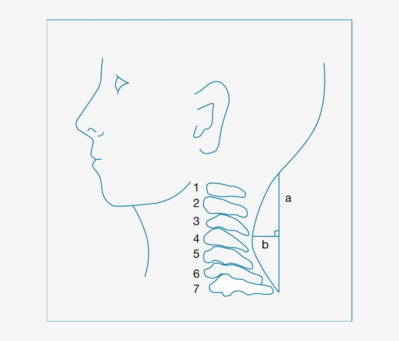 Measurement Of Cervical Curve With Flexible Ruler - Drawing - Free ...