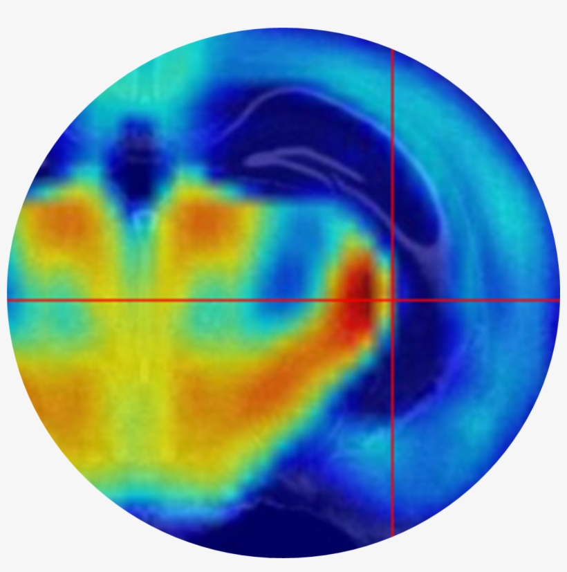 Mouse Brain Atlas - Free Transparent PNG Download - PNGkey