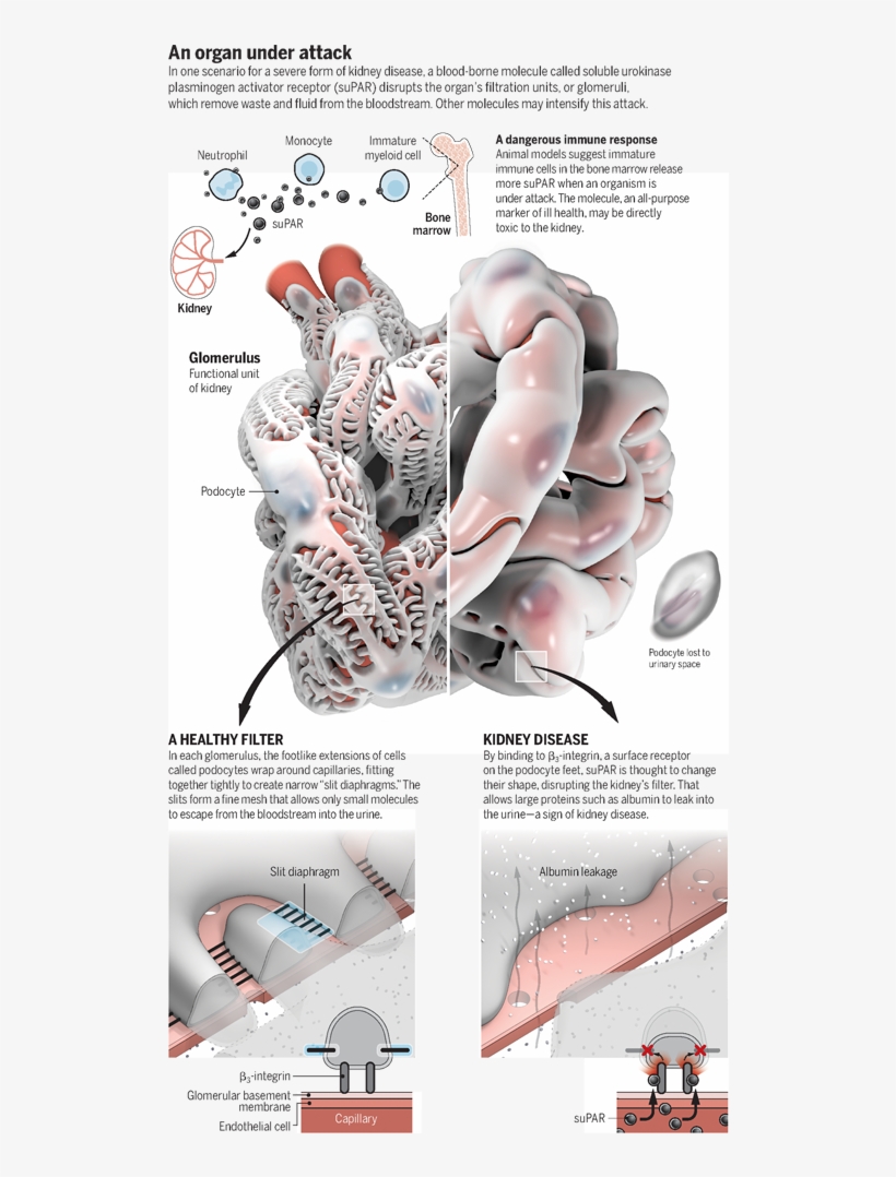 Supar And Kidney Disease - Diagram - Free Transparent PNG Download - PNGkey