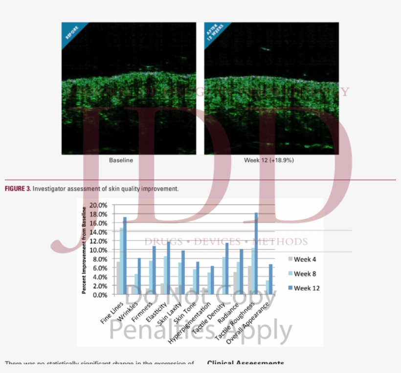 Ultrasound Image From Crow's Feet - Diagram - Free Transparent PNG ...