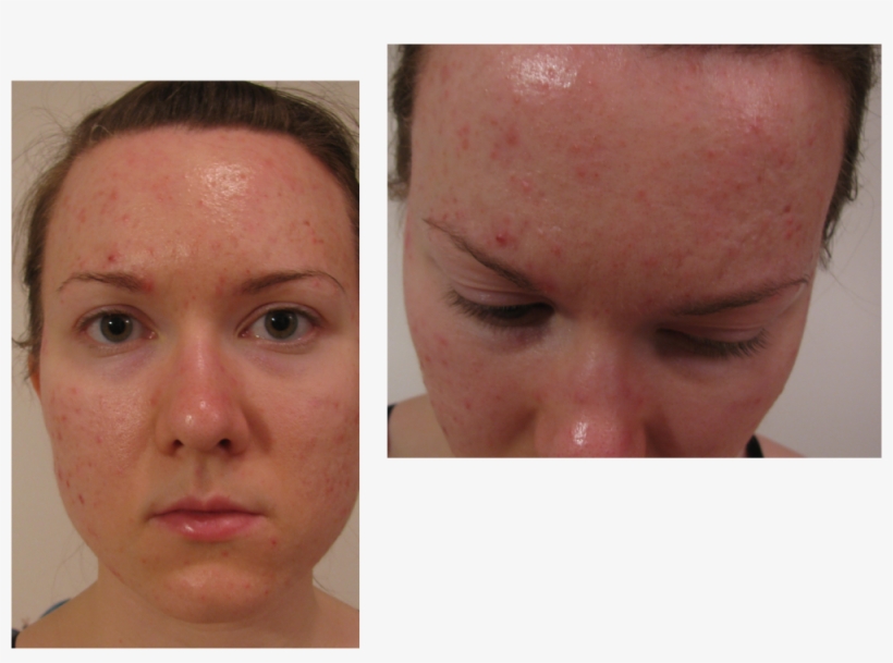 Picture23 - Scar - Free Transparent PNG Download - PNGkey