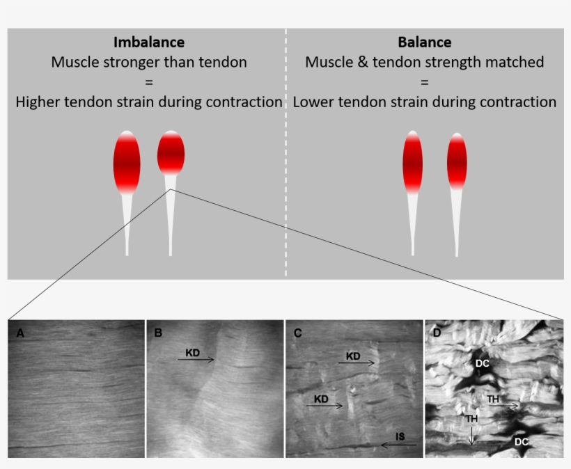 An Increase In The Stiffness Of The Tendon Results - Diagram - Free ...