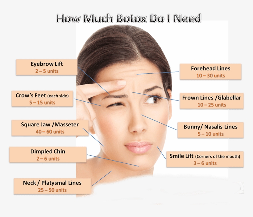 Botox Dosage Chart - Can I Get Botox On My Face - Free Transparent PNG ...