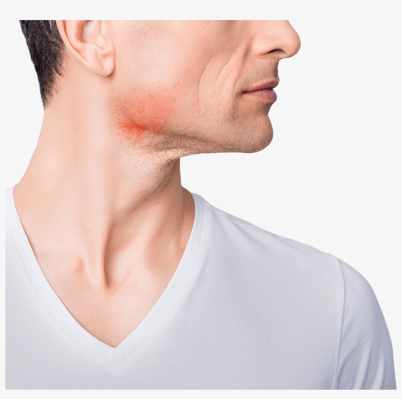 Transparent Skin Causes Transparent Background - Male - Free ...