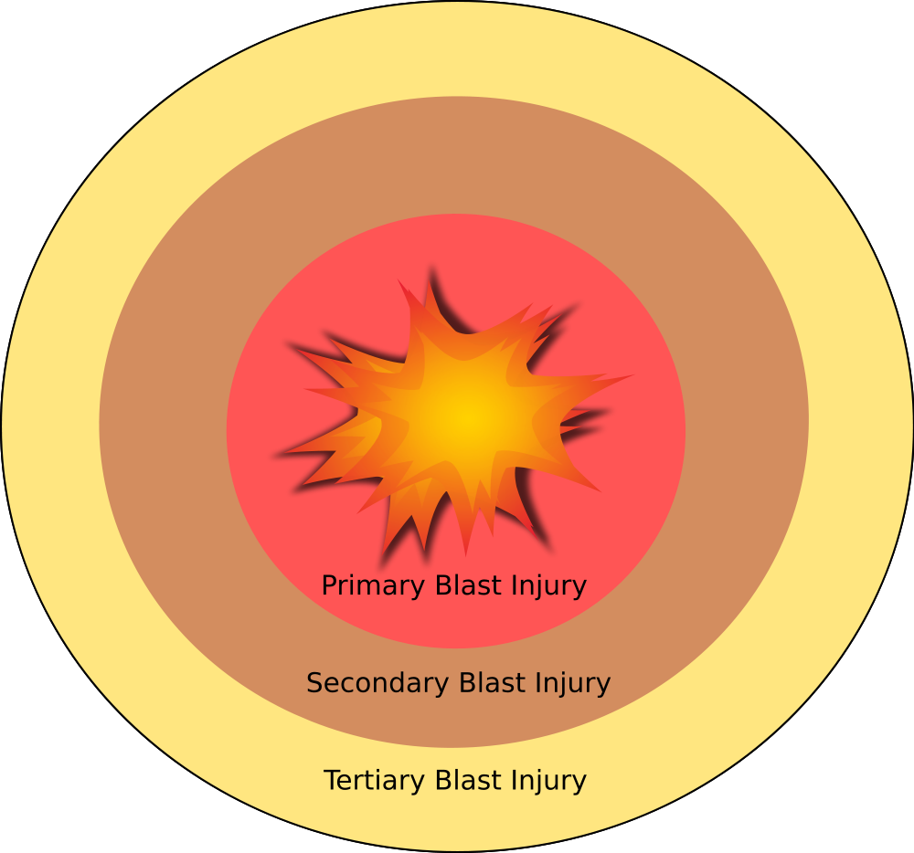Download Open - Explosion Anatomy PNG Image with No Background - PNGkey.com