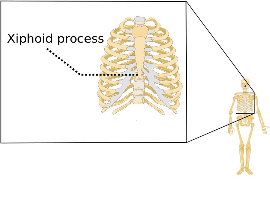 Download File - Xiphoid Process - Svg - Skeletal System Xiphoid Process ...