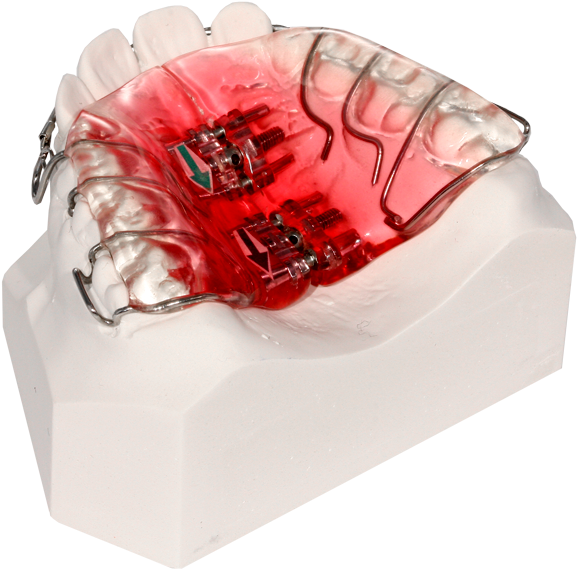 Download Upper Spit Plate - Ring PNG Image with No Background - PNGkey.com