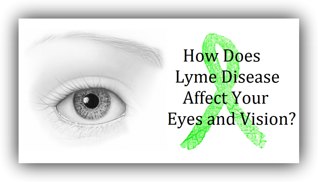 Download How Has Lyme Disease Affected Your Vision - Lyme Disease Eyes ...