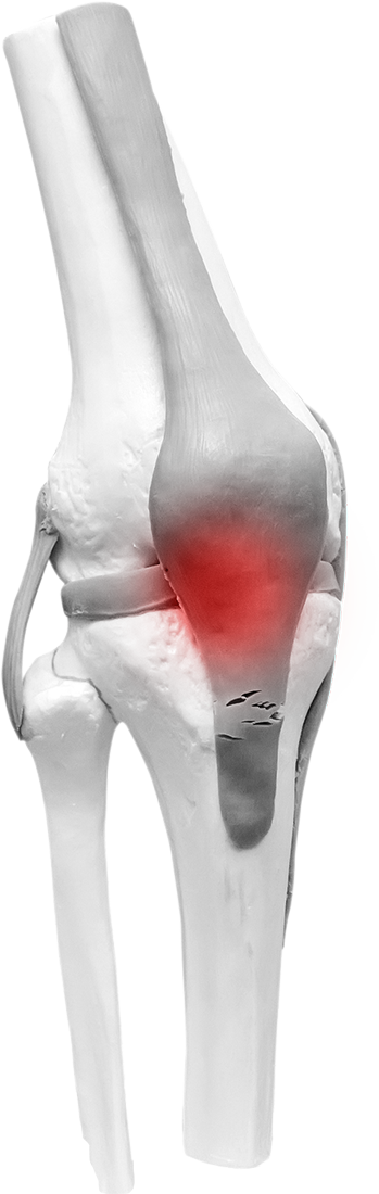 Download Bone Joint PNG Image with No Background - PNGkey.com