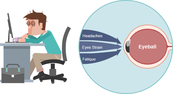 Download Eye Strain Eye Strain - Eye Strain Transparent PNG Image with ...