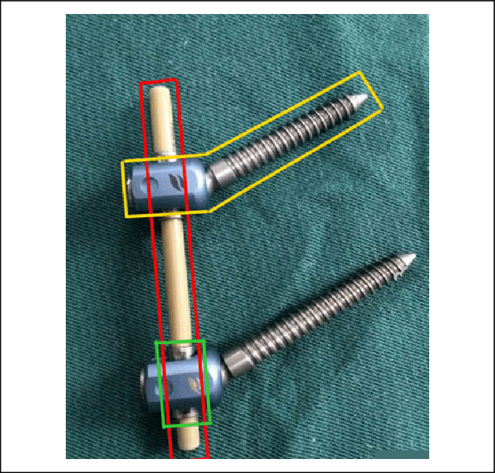 Download The K-rod System Used In This Study - Alloy PNG Image with No ...