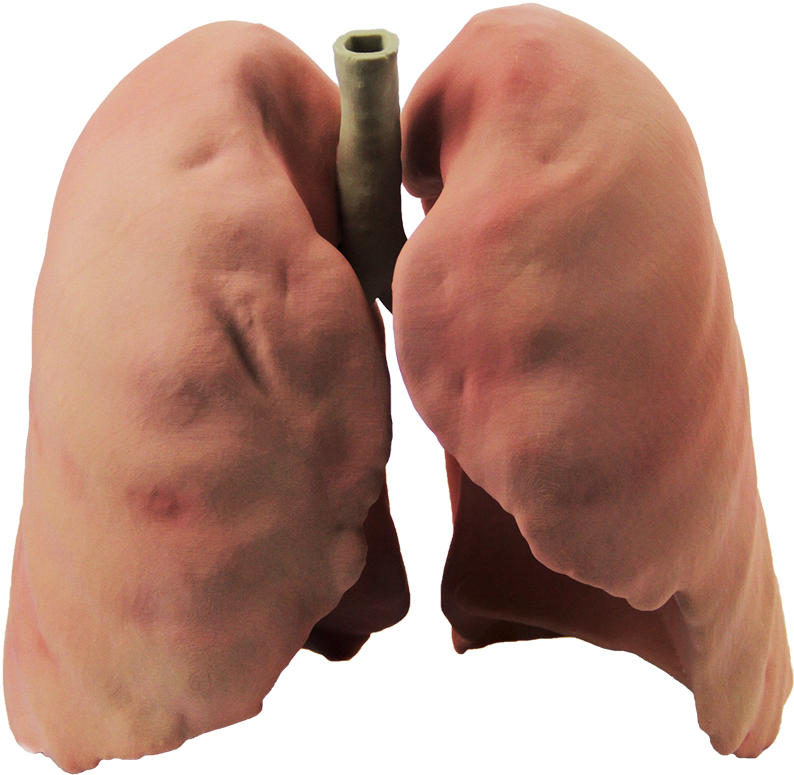 Download T Lt - Real Lungs Png PNG Image with No Background - PNGkey.com
