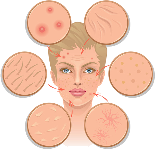 Download Treat Acne Scars - Face Skin Concerns PNG Image with No ...