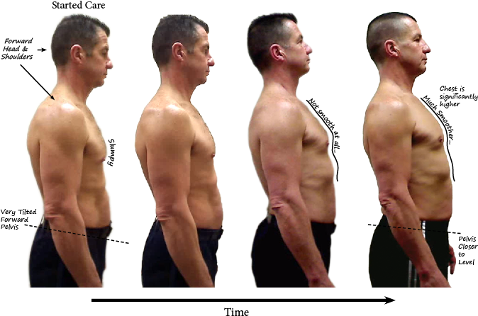 Download Normal Male Posture PNG Image with No Background - PNGkey.com