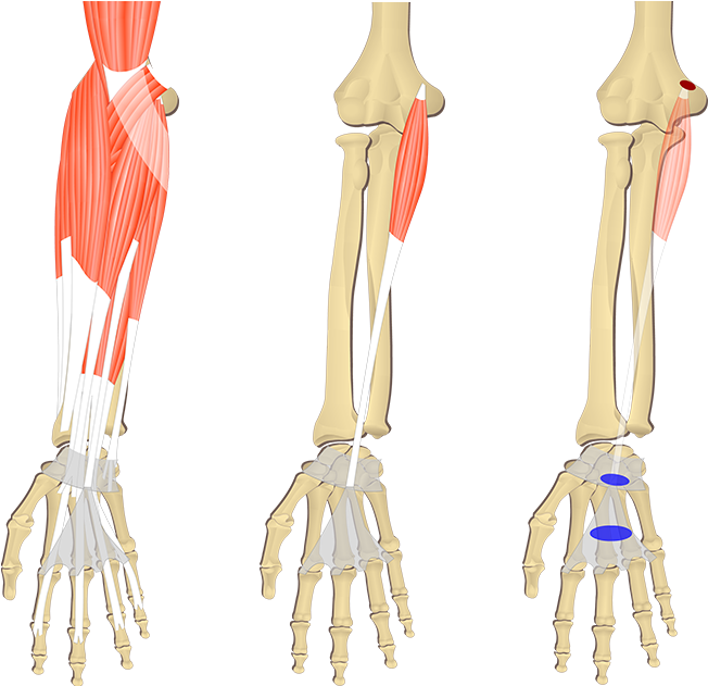 Download Palmaris Longus Muscle - Flexor Digitorum Superficialis Origin ...
