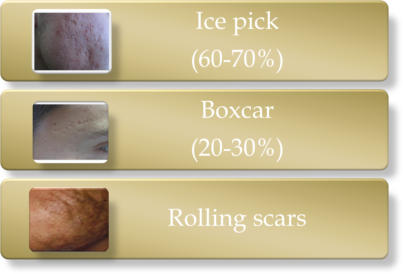 Picture14 - Boxcar Ice Pick Scars - Free Transparent PNG Download - PNGkey