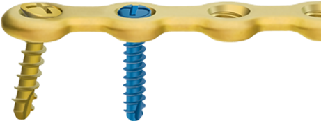 Download Locking Reconstruction & Mini Plate System - Reconstruction ...