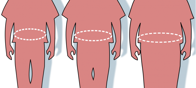 Overweight - Obesity Diagram - Free Transparent PNG Download - PNGkey